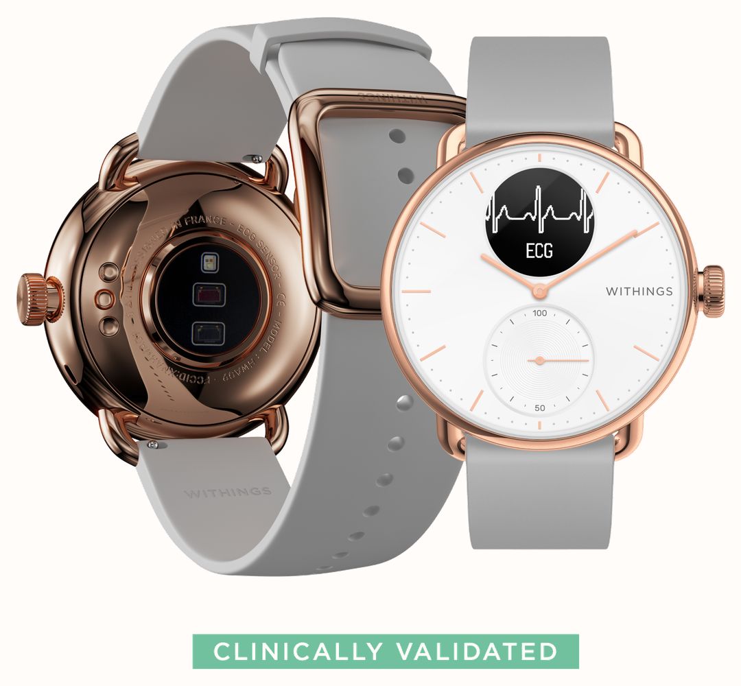 Withings Гибридные смарт-часы Scanwatch 38 мм HWA09-MODEL 5-ALL-INT ...